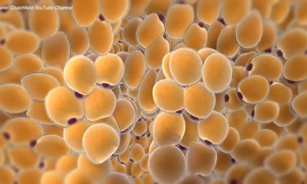 Dr. Lindes Cryolipo® | Kryolipolyse – Coolsculpting | LIPOCLINIC